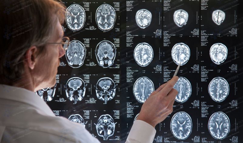 CAT Scan vs CT Scan: The Real Difference | medicalimagingsource.com