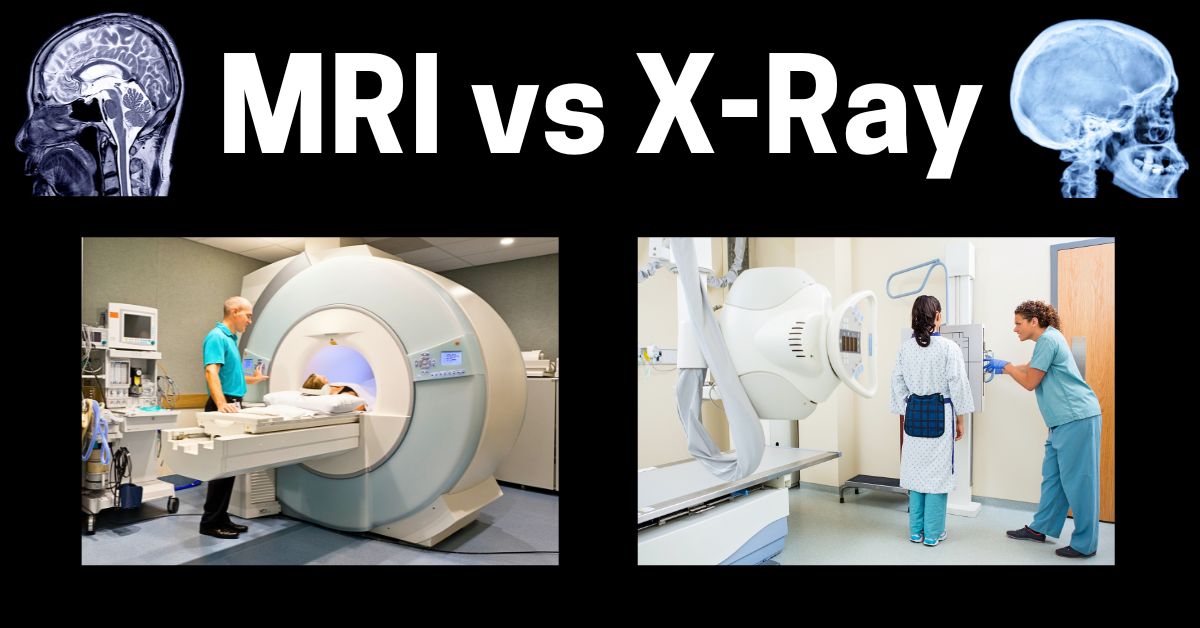 Mri Vs X Ray Whats The Difference