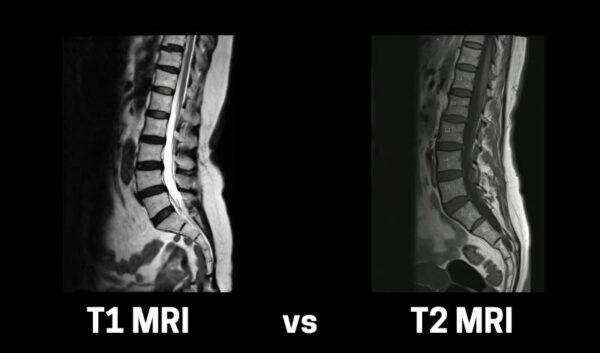 Contrast Media in Radiology: MRI, CT & PET Explained ...