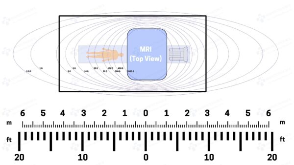What is a Gauss? Understanding Magnetic Field Strength in MRI
