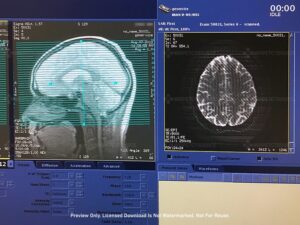 Full Body MRI: Is It Worth It? | medicalimagingsource.com