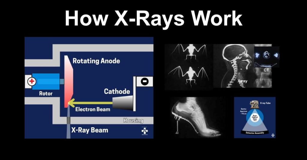 MRI Scanner Components: How MRI Machines Work & Key Parts ...